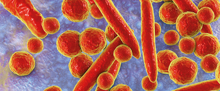 Mycoplasma genitalium-related infection: An STI not quite ready for ...